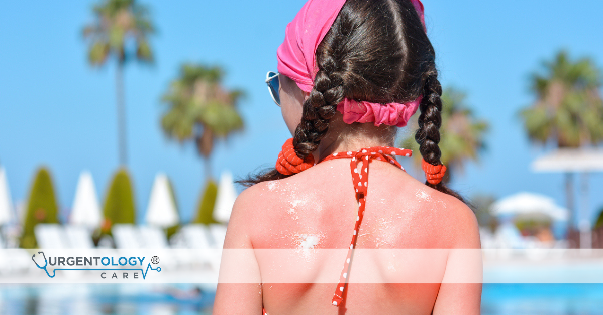 What Do I Do If My Child Gets Sun Poisoning?